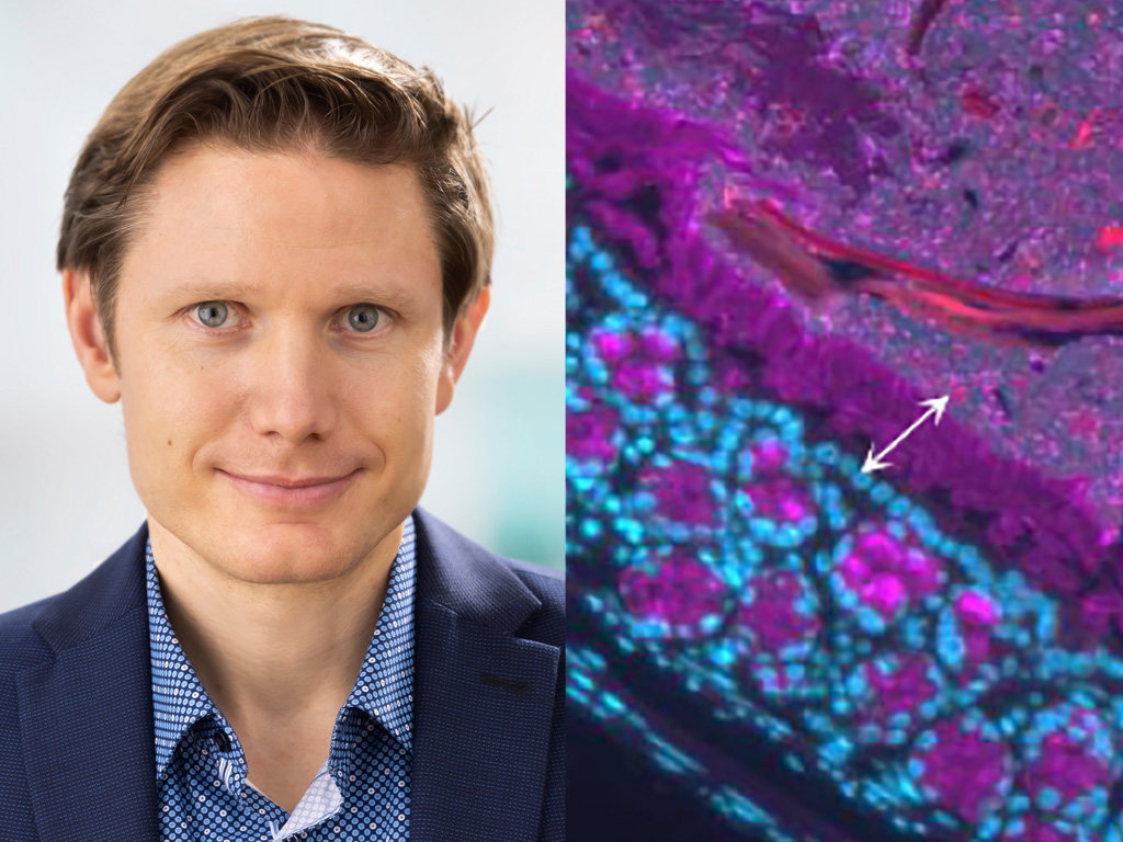 Zeiser Laboratory | Universitätsklinikum Freiburg