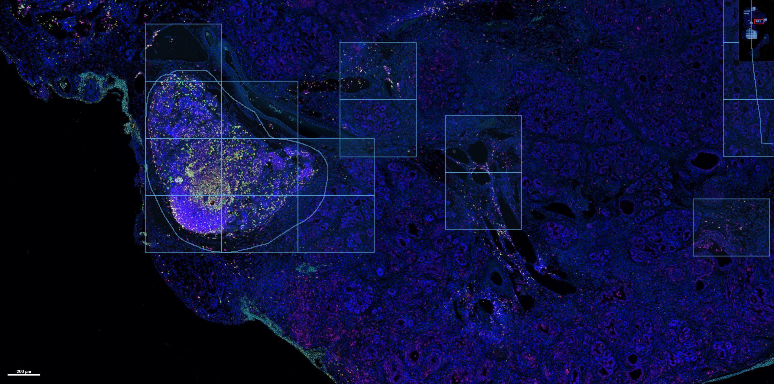 Spatial Biology - Akoya PhenoCycler-Fusion (CODEX ...