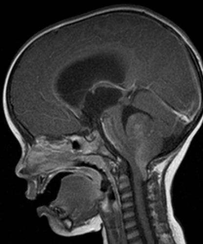 Kinderneuroradiologie | Universitätsklinikum Freiburg