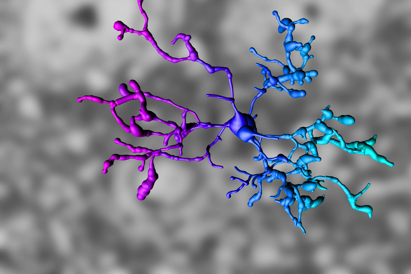 Institut für Neuropathologie | Universitätsklinikum Freiburg